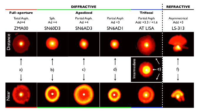Halos y lentes intraoculares multifocales: ¿qué nos dice el banco ...