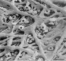 Glaucoma: Nuevas vías de tratamiento - Qvision