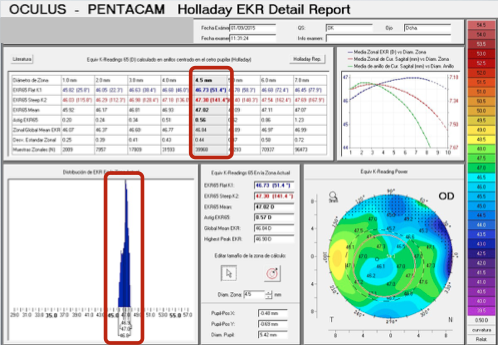 Pentacam: Selección de LIOS: Lentes Multifocales (1/3) - Qvision